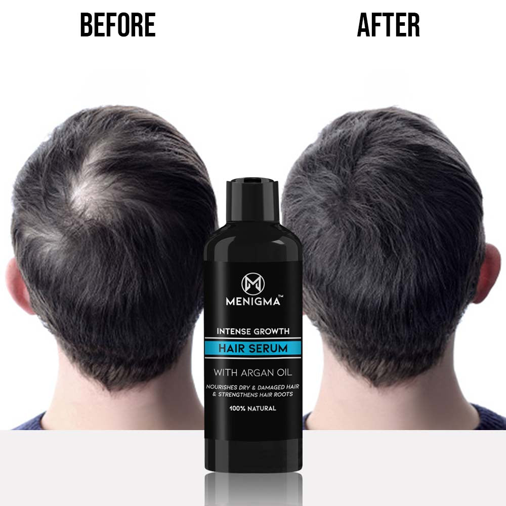 Men’s Hair Care Products, Oils & Serums – Menigma Pakistan Official